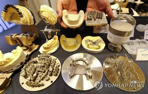 인체에 안전한 금속재료로 만든 치아 보철물