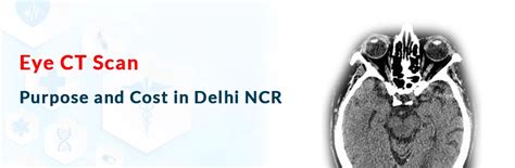 Eye Ct Scan Purpose And Cost In Delhi Ncr Ganesh Diagnostic