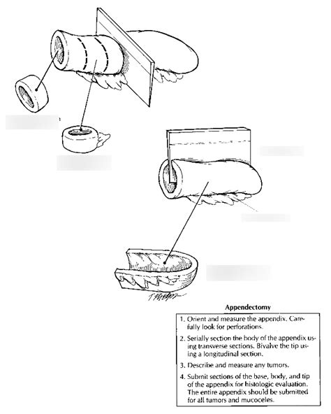 Appendix Sectioning Diagram Quizlet