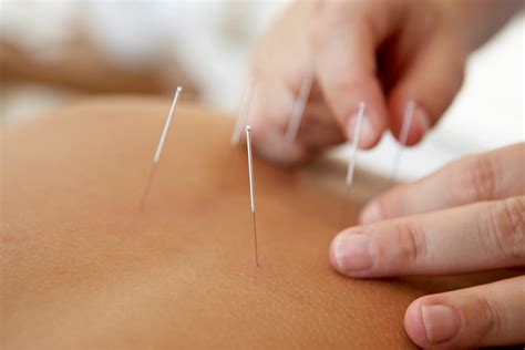 Trigger Point Acupuncture