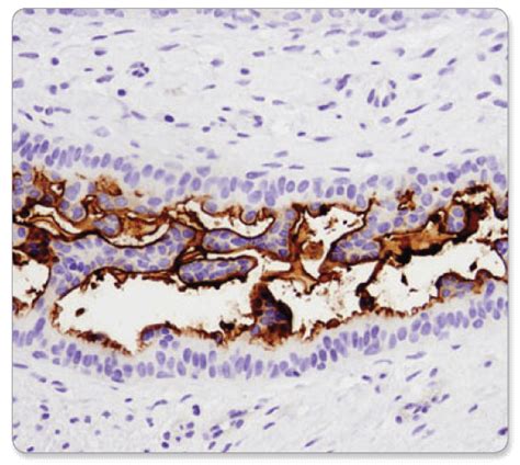 Principles Of Immunohistochemistry Ihc Staining Cell Signaling