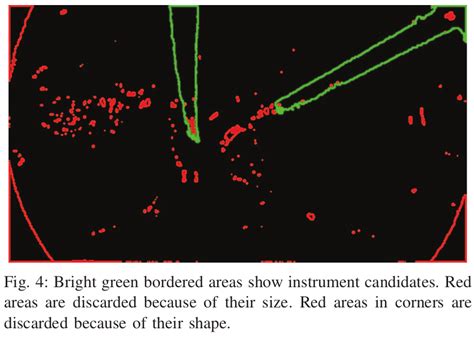 Instrument And Phase Detection In Cholecystectomy Surgery Videos
