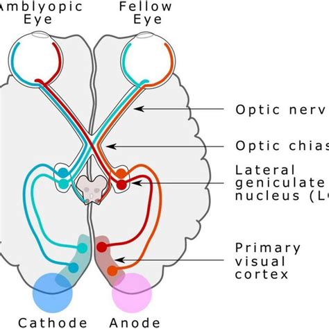 bilateral transcranial direct current stimulation tdcs electrode
