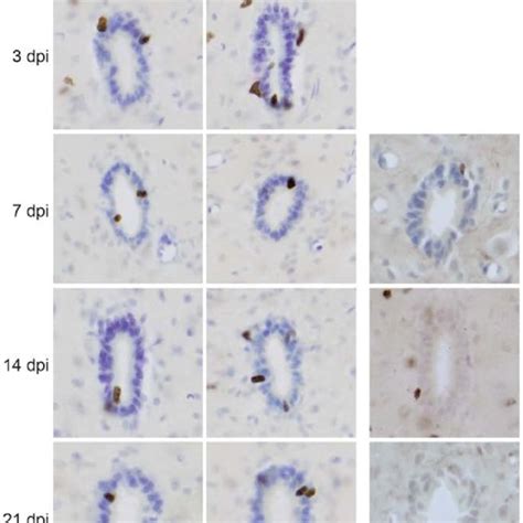 Ependymal Cells Do Not Proliferate In Response To Lpc And Eae Models Of Download Scientific