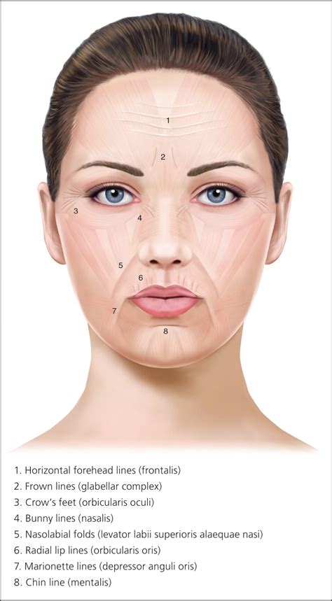 Botox Injection Site Forms