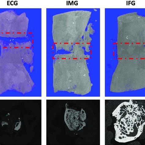 Micro Computed Tomography In The Bone Defect Area Micro Ct Of The