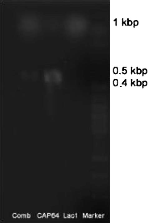 Molecular Characterization Of Cryptococcus Spp Identification Of This