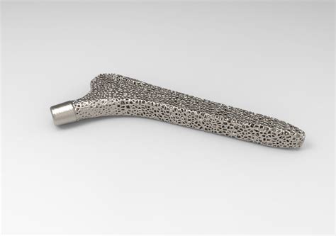 How To Optimize A Patient Specific Hip Implant Stem Ntop Ntop