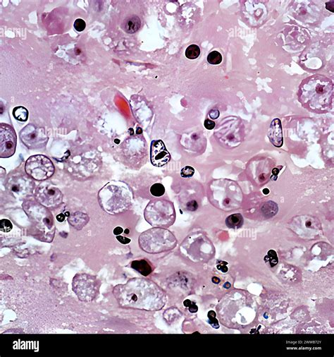 Balamuthia Mandrillaris Is A Free Living Amoeba A Single Celled Living