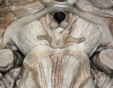Fiber Dissection Of The Upper Brainstem Neuroanatomy The