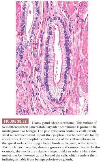 Common Bile Duct Histology