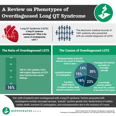Visualized A Review On Phenotypes Of Overdiagnosed Long Qt Syndrome