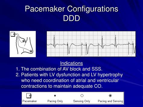 Ppt Pacemakers Powerpoint Presentation Free Download Id 231622