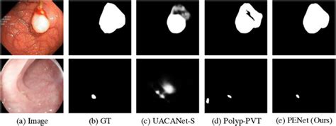 Parallel Matters Efficient Polyp Segmentation With Parallel Structured