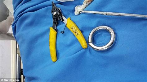 Thai Man Has A Sex Ring Removed With BOLTCUTTERS After It Became Stuck On His Penis Daily Mail