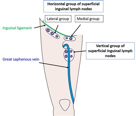 Lymphatic Drainage Of Lower Limb Anatomy Qa