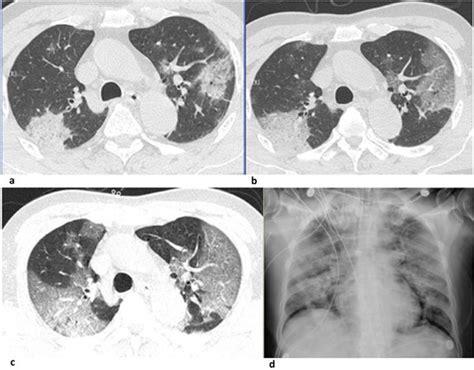 What Do The Functional Groups Of Fexofenadine Do Once It Enters Our Body Quora