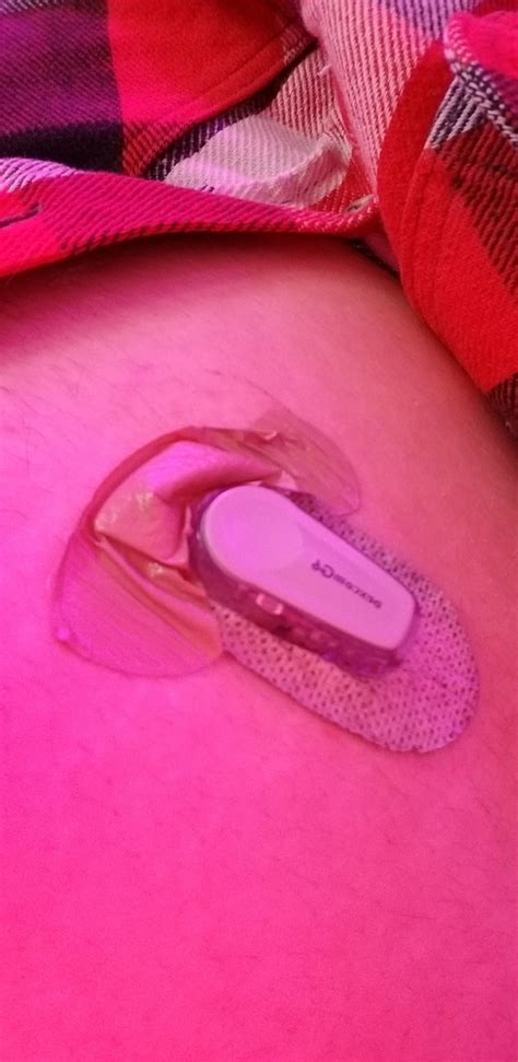 Best R Dexcom Images On Pholder Wtf Is The Point Of The Codes If You Re Just Going To Send