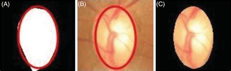 Results Of Od Segmentation A Best‐fit Ellipse B Detected Od
