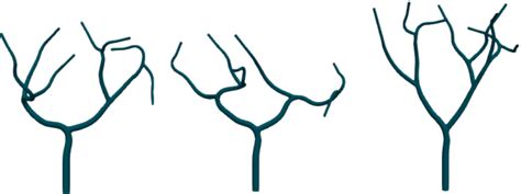 Figure 1 From Transient Hemodynamics Prediction Using An Efficient Octree Based Deep Learning