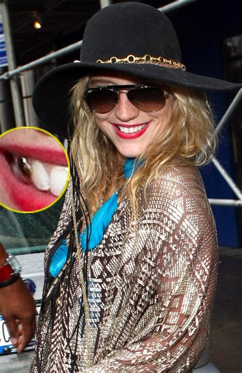 Kesha Gold Tooth