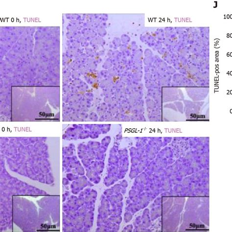 P Selectin Glycoprotein Ligand 1 Deficiency Alleviates Download