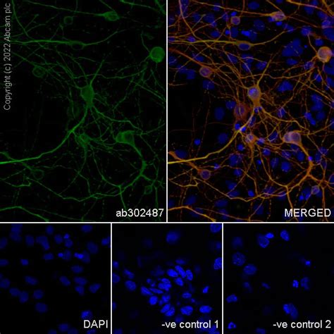 Anti Map2 Antibody Epr19691 Goat Igg Chimeric Ab302487 Abcam