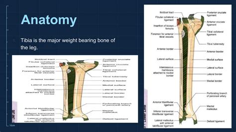 Proximal Tibia Fracture And Mechanism With Etiology PPTX