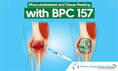 Musculoskeletal And Tissue Healing With Bpc 157 Weight Loss And Vitality Medical Weight Loss