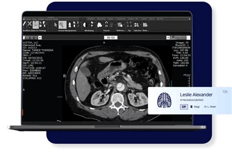 Accurate And Rapid Ai Based Detection Of Aortic Conditions