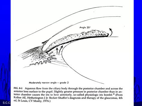 Iop Ppt Thyroid Disorders Endocrine And Metabolic Diseases
