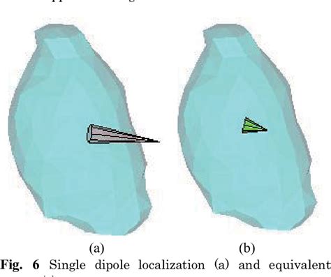 Figure 6 From Single And Distributed Dipole Models Analysis Of Cardiac