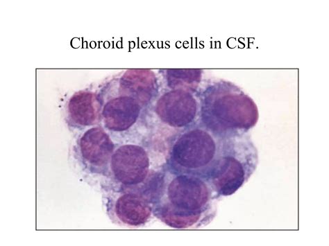 Fluid Cytology In Csf Ppsx