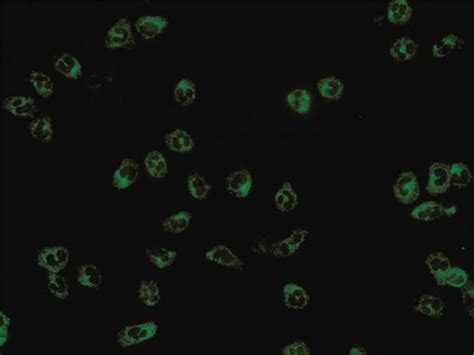 Comparison Between Enzyme Linked Immunosorbent Assay And Indirect Immunofluorescence For
