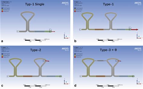 Loading Conditions Of Key Loops Archwire With Key Loops Was Fixed On