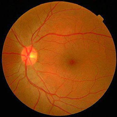 Iris Recognition Vs Retina Scanning What Are The Differences M2SYS Blog On Biometric