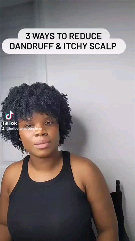 How To Eliminate Scalp Dandruff Artofit