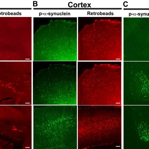 Appearance Of P α Synuclein Inclusions In Brain Areas That Project To Download Scientific