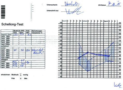 Severe Symptomatic Hyponatremia Due To Cerebral Salt Wasting Syndrome In A Patient With