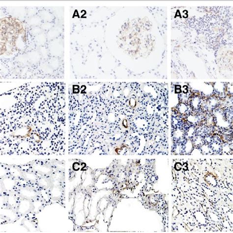 Details Of C4d Deposition In Patients With Pss Mn Download Scientific Diagram