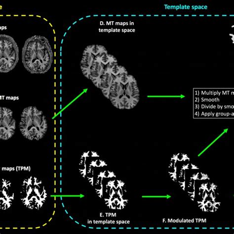 Preprocessing Pipeline Download Scientific Diagram