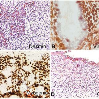 Photomicrographs Of The Cervical Polyp A Shows Immunoreactivity To Download Scientific