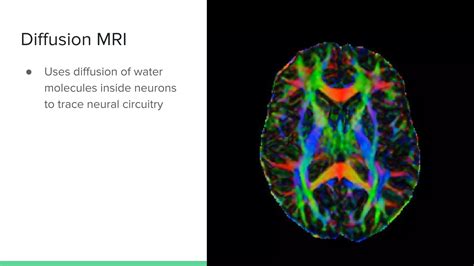Msc Big Data Connectomics Talk Pdf