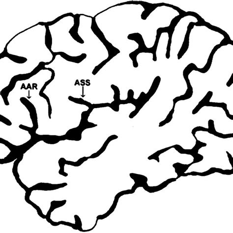 Asymmetry Quotients Of Pars Triangularis And Pars Opercularis