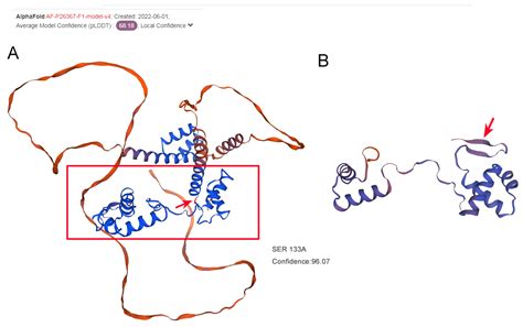 Jpm Free Full Text A Novel Pax6 Frameshift Mutation Identified In A