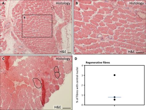 Isolation And Characterization Of Myogenic Precursor Cells From Human