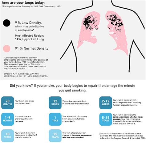 Technique Of The Week Segmentation 3d And Quantitative Imaging Laboratory