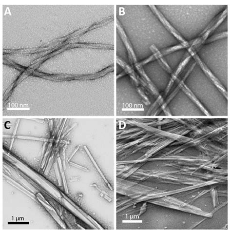 Beta Pleated Sheet Amyloid