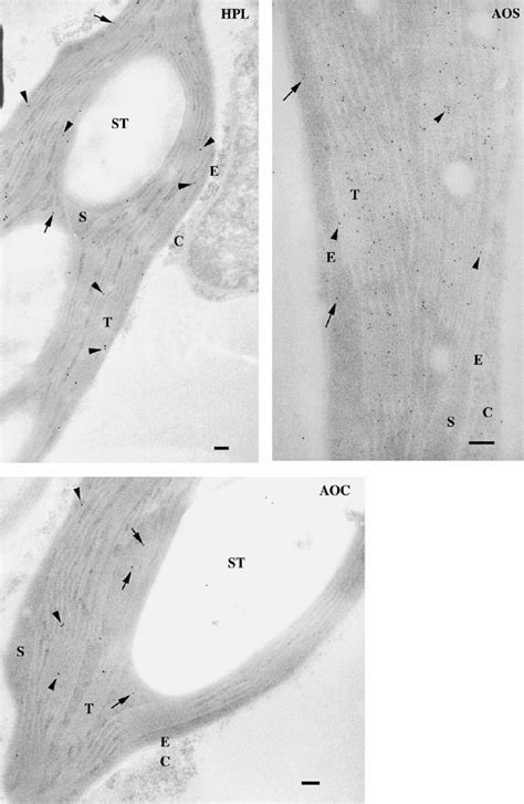 Electron Microscopy Of Lipoxygenase Pathway Proteins Localization Of Download Scientific