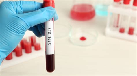 Key Information To Consider Before Undergoing Std Testing